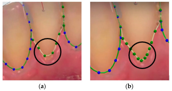 Tooth Segmentation of 3D Scan Data Using Generative Adversarial Networks