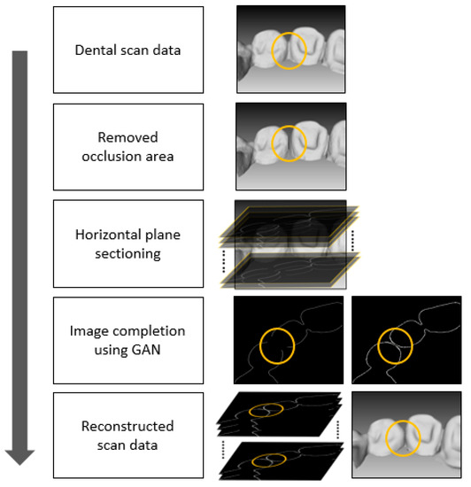 Tooth Segmentation of 3D Scan Data Using Generative Adversarial Networks