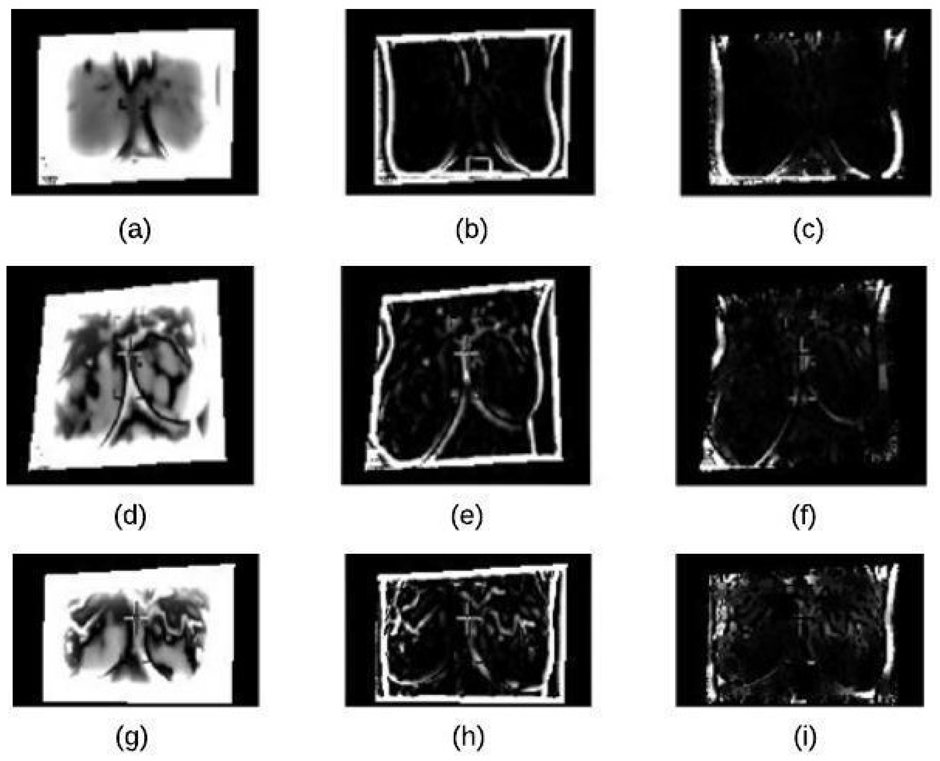 Thermogram Breast Cancer Detection: A Comparative Study of Two Machine ... Thermogram Breast Cancer Detection: A Comparative Study of Two Machine ...