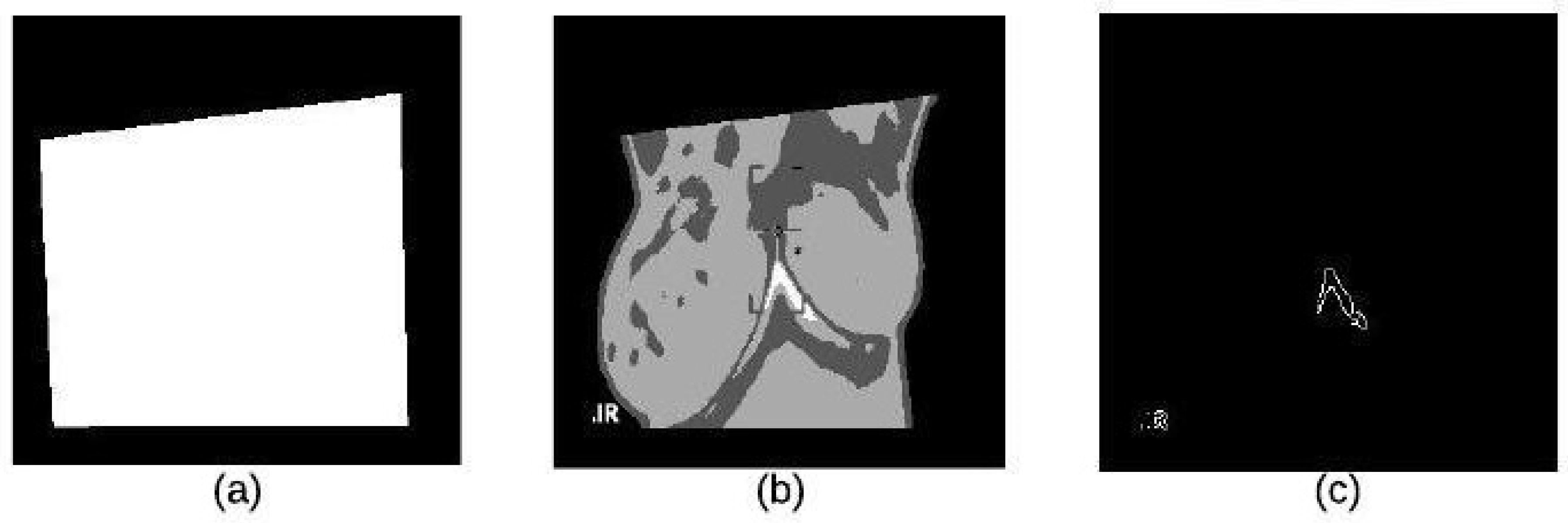 Thermogram Breast Cancer Detection: A Comparative Study of Two Machine ... Thermogram Breast Cancer Detection: A Comparative Study of Two Machine ...