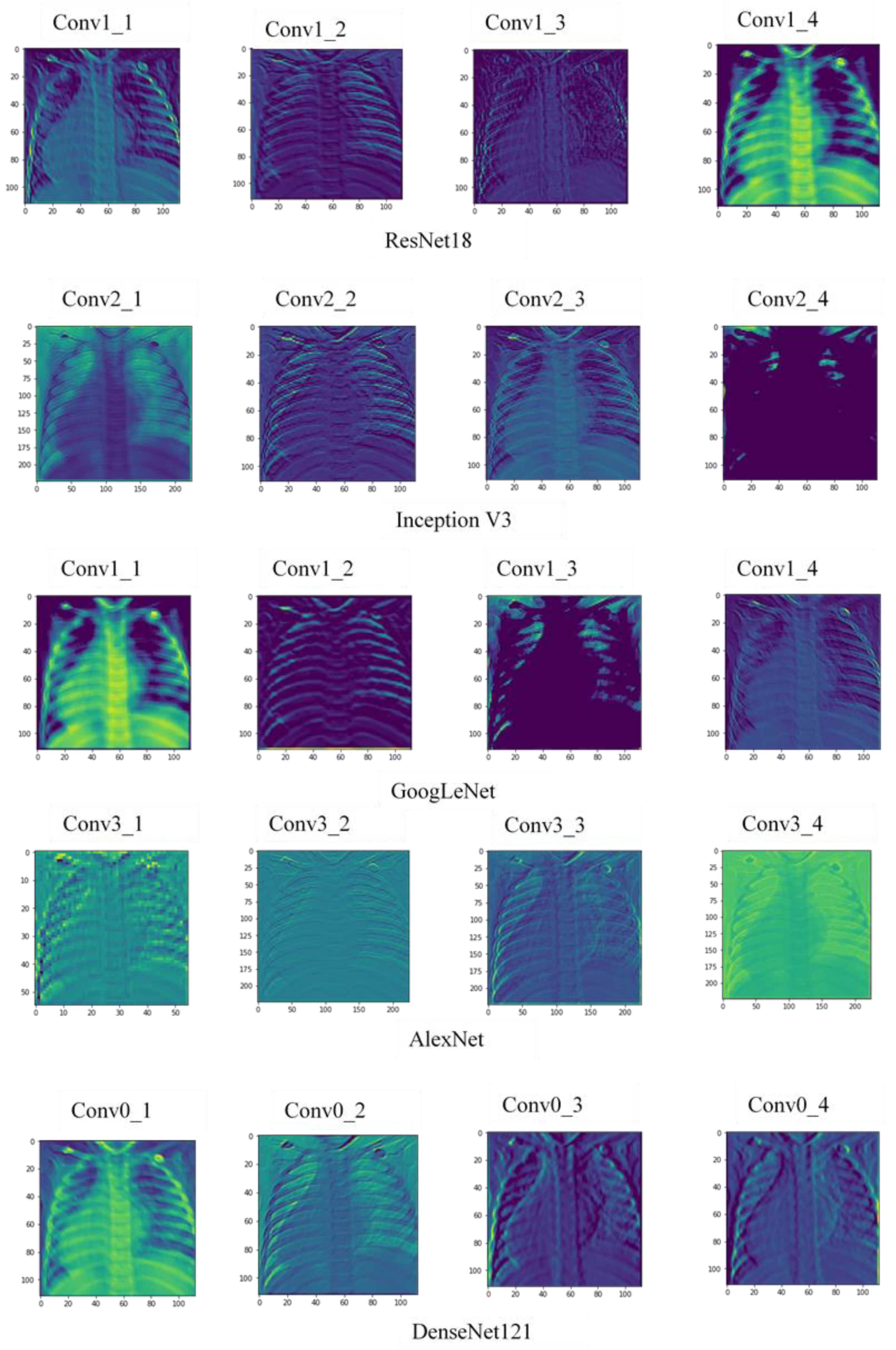 A Novel Transfer Learning Based Approach for Pneumonia Detection in ...