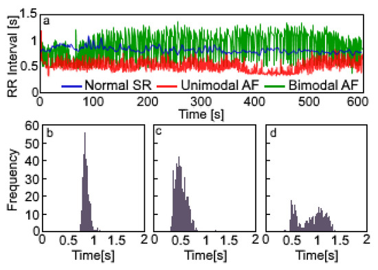 Computational Simulation of Cardiac Function and Blood Flow in the ...