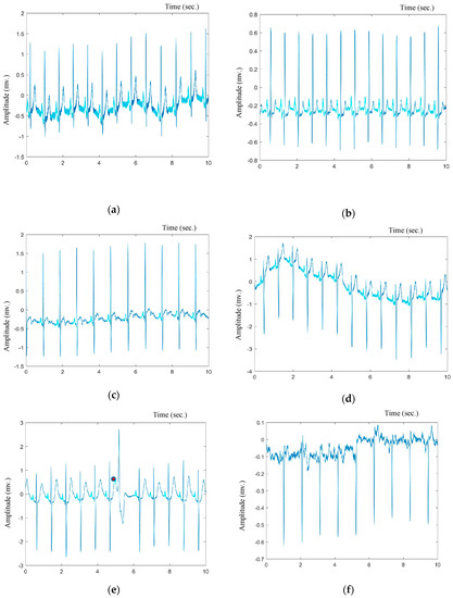 P-Wave Detection Using a Fully Convolutional Neural Network in ...