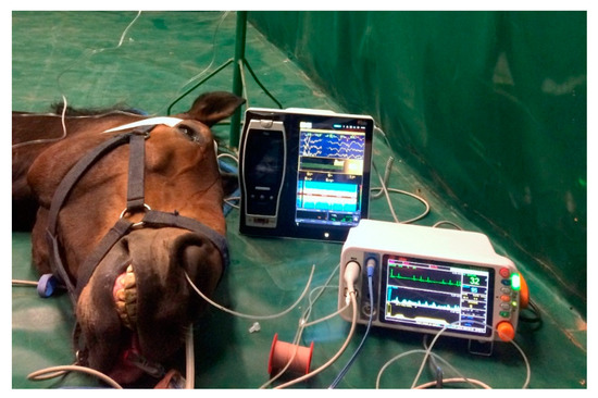 Preliminary Study of the Use of Root with Sedline® EEG Monitoring for ...