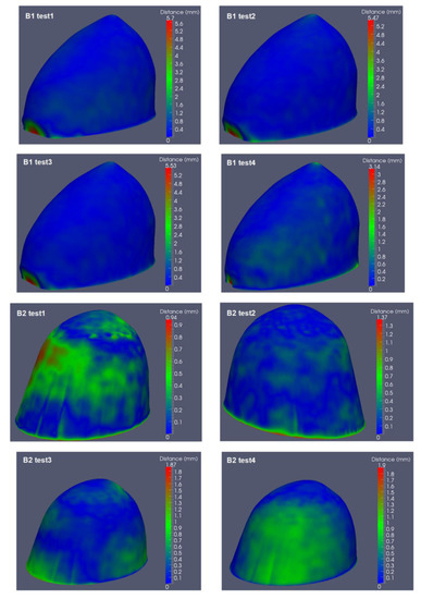 Wavelia Breast Imaging: The Optical Breast Contour Detection Subsystem