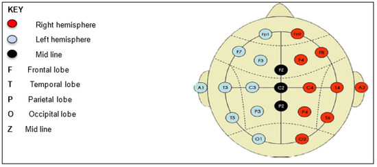 Deep Learning for EEG-Based Preference Classification in Neuromarketing