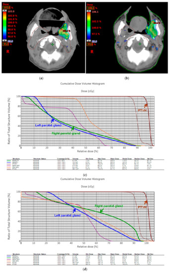 Three-Dimensional Printed Silicone Bite Blocks for Radiotherapy of Head ...