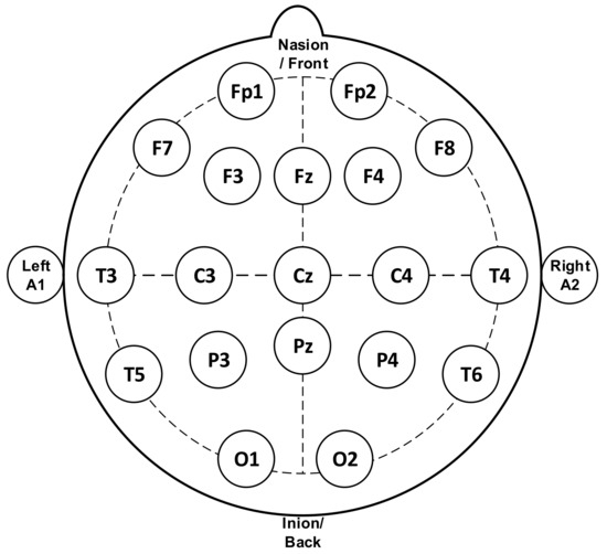 Classification of Brainwaves for Sleep Stages by High-Dimensional FFT ...