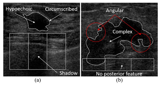 A Novel Computer-Aided-Diagnosis System for Breast Ultrasound Images ...