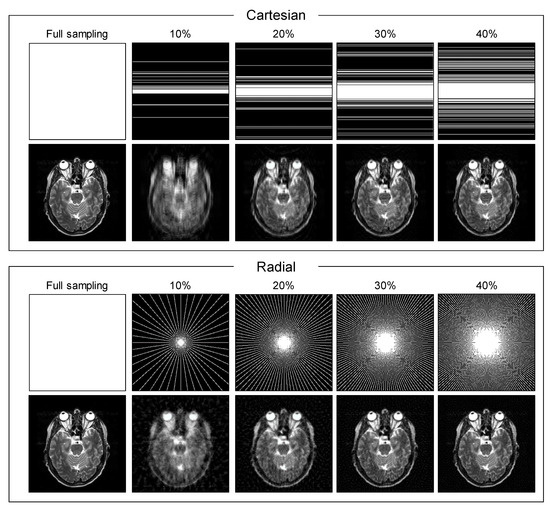 Compressed-Sensing Magnetic Resonance Image Reconstruction Using an ...