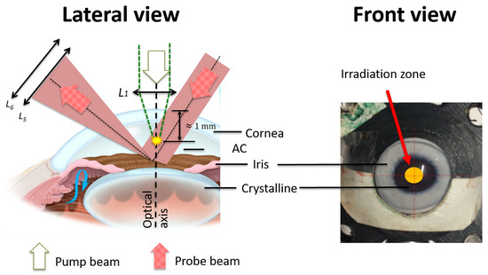 Intraocular Pressure Study in Ex Vivo Pig Eyes by the Laser-Induced ...