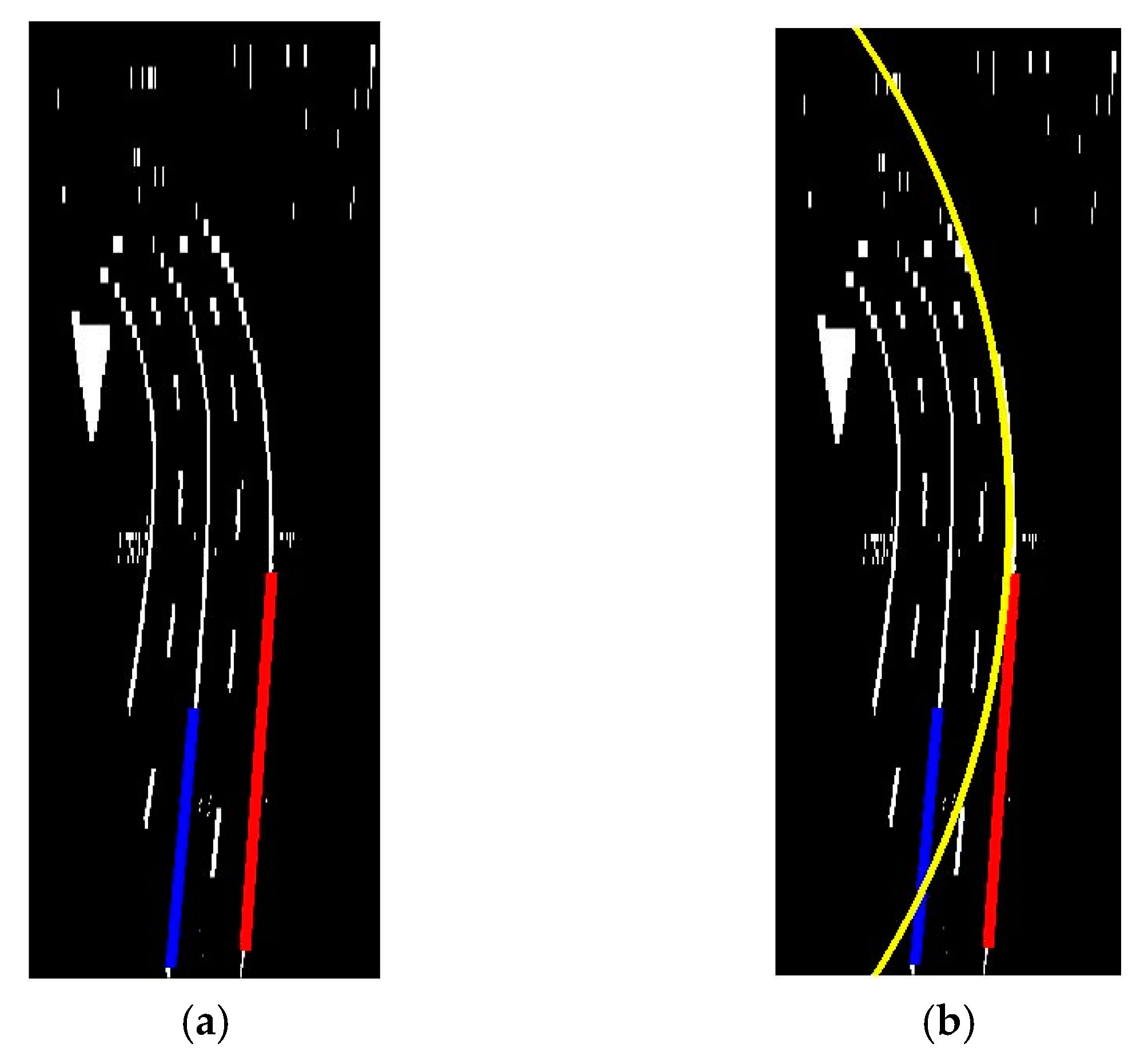 Highly Curved Lane Detection Algorithms Based on Kalman Filter
