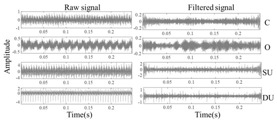 Stepwise Intelligent Diagnosis Method for Rotor System with Sliding ...