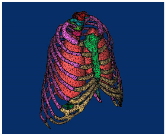 Accident Reconstruction of Damaged Human Body Using MDCT and Computer ...