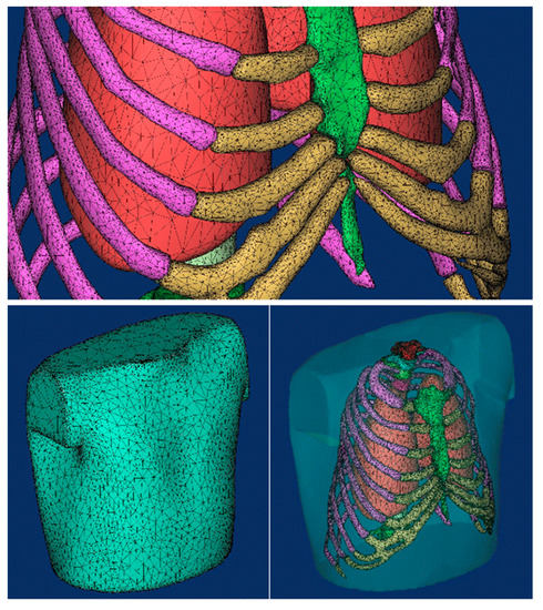 Accident Reconstruction of Damaged Human Body Using MDCT and Computer ...