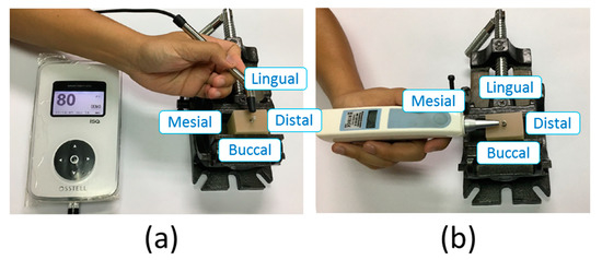The Effect of Insertion Angles and Depths of Dental Implant on the ...
