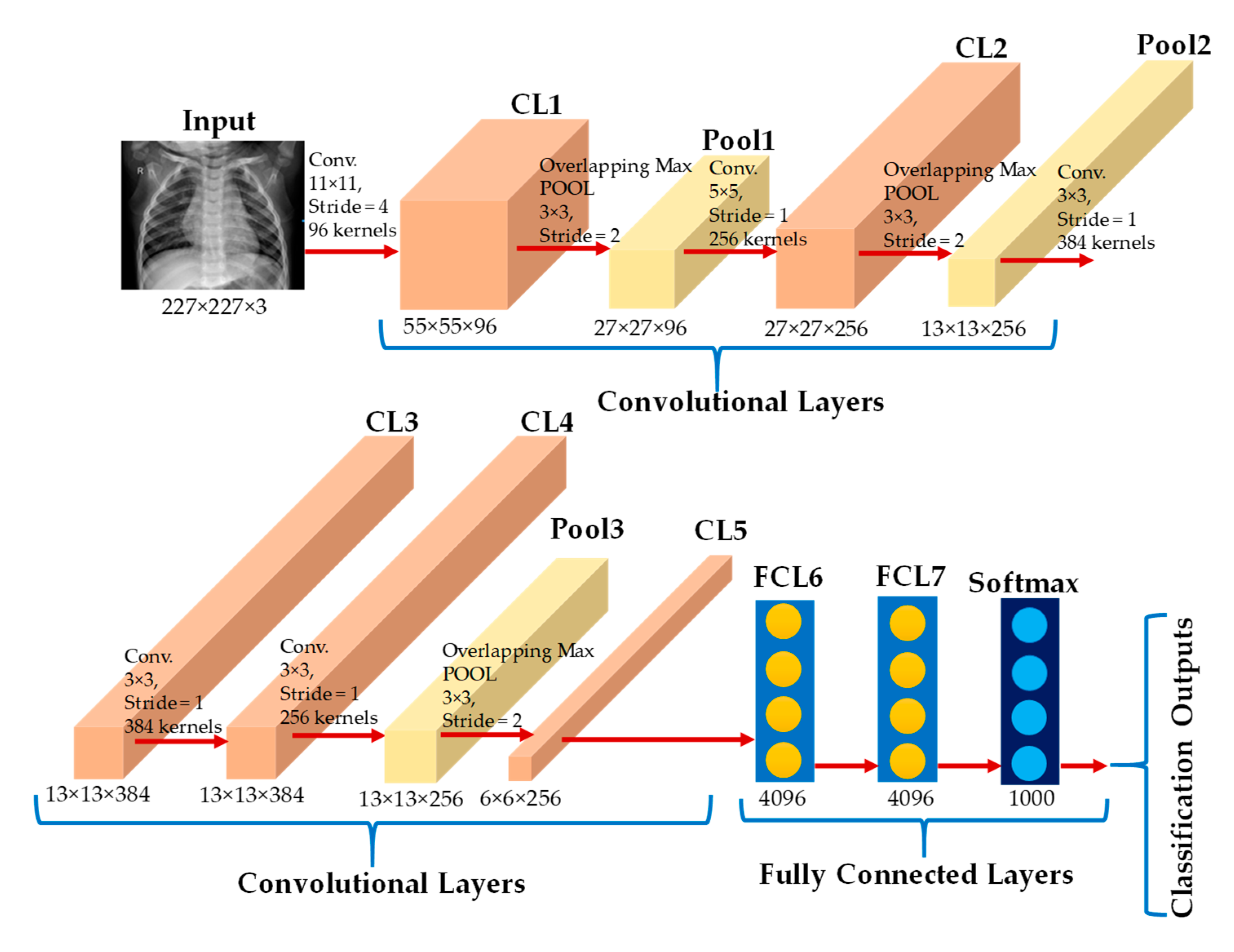 Chest X Rays Pneumonia Detection Using Convolutional - vrogue.co Chest X Rays Pneumonia Detection Using Convolutional - vrogue.co