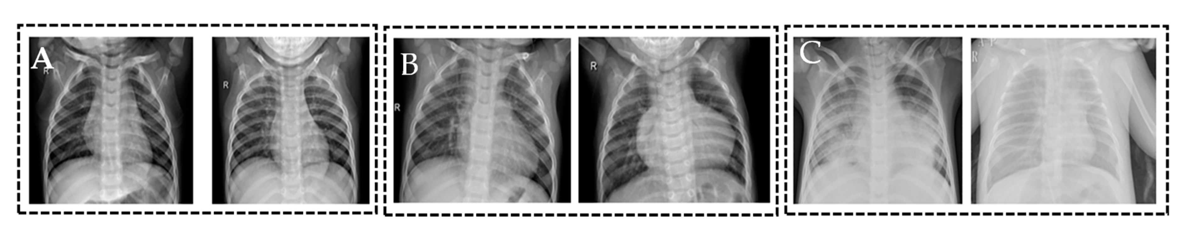Applied Sciences | Free Full-Text | Transfer Learning with Deep Convolutional Neural Network ...