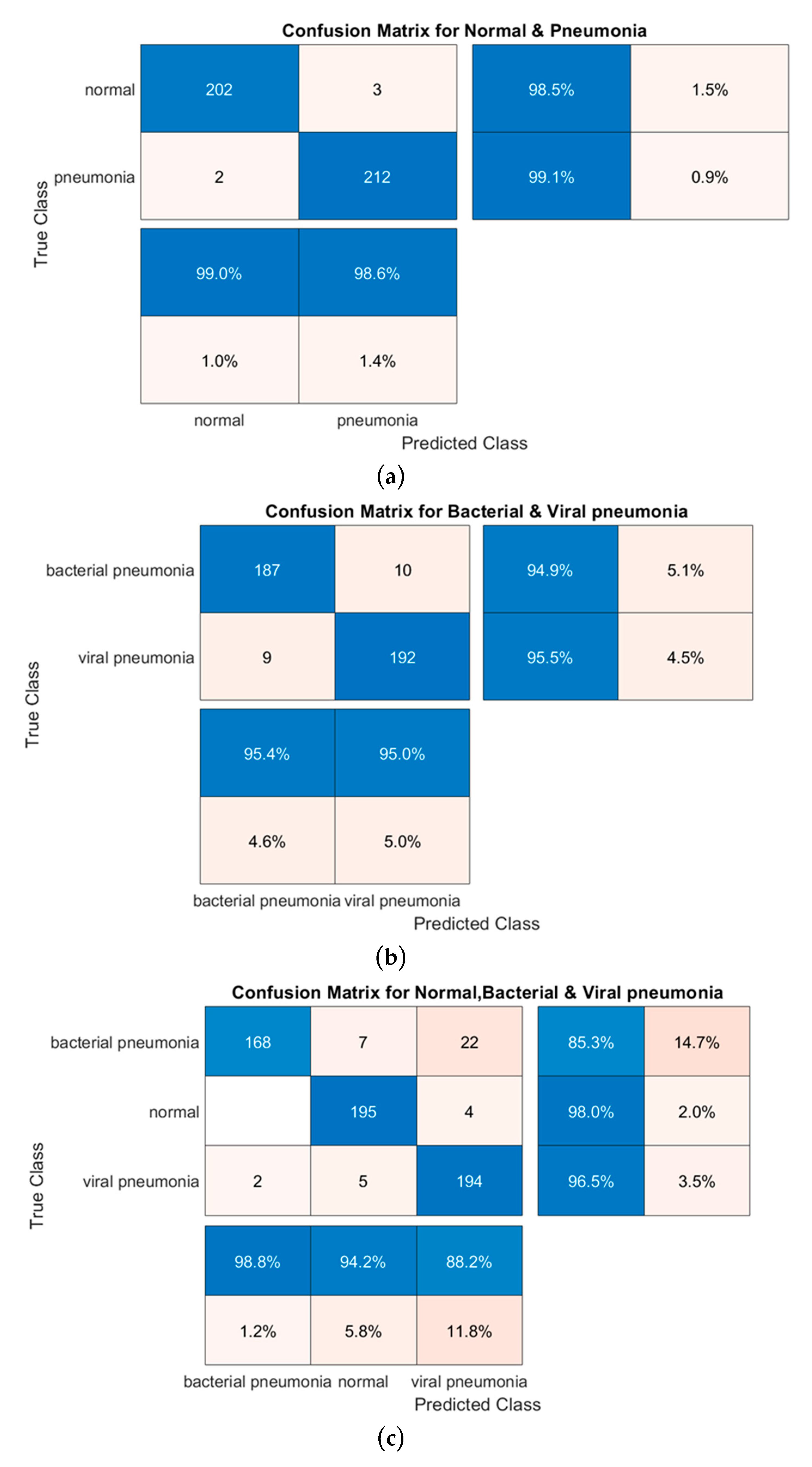 Transfer Learning with Deep Convolutional Neural Network (CNN) for Pneumonia Detection Using ...