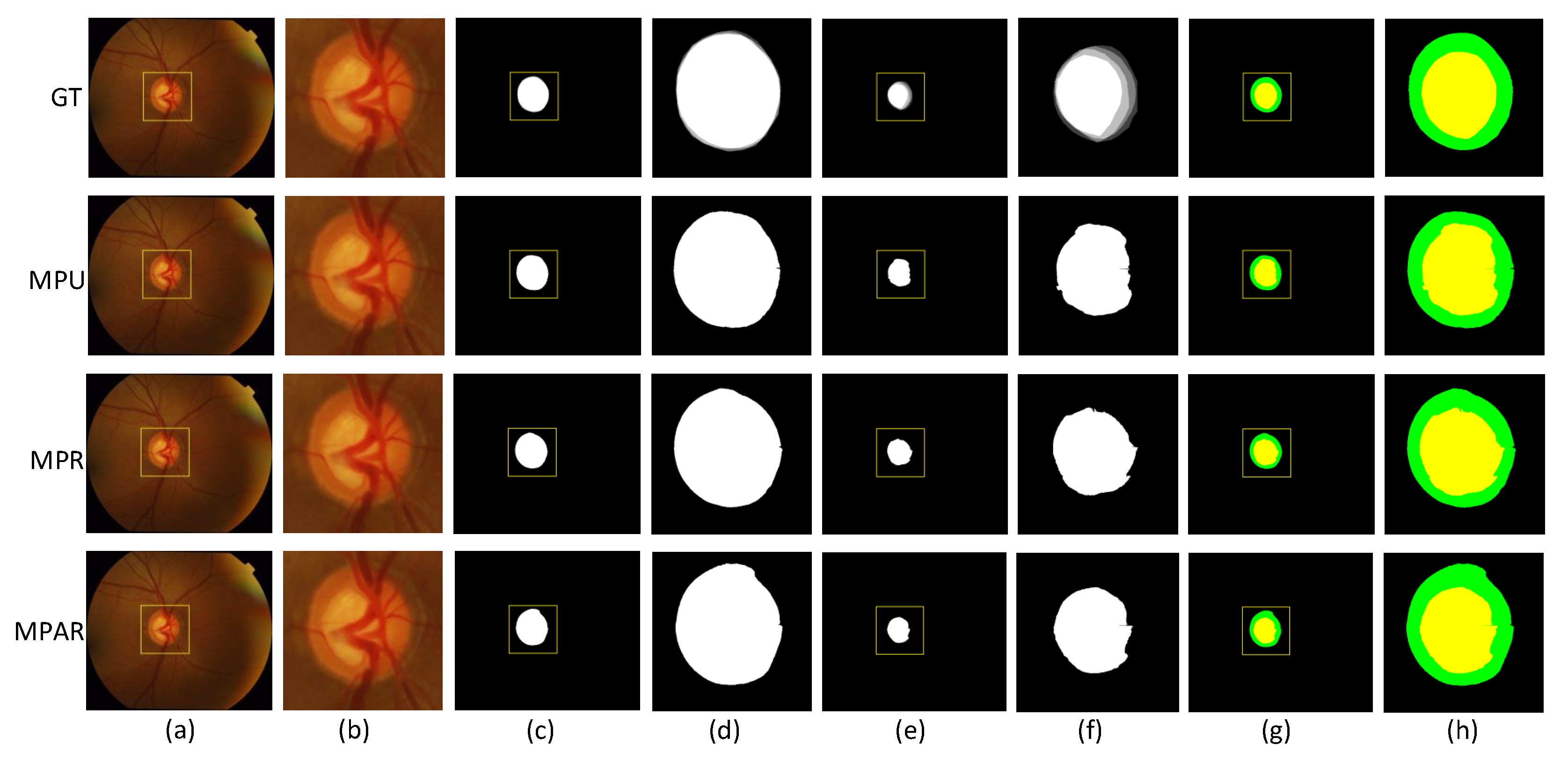 Multi-Path Recurrent U-Net Segmentation of Retinal Fundus Image