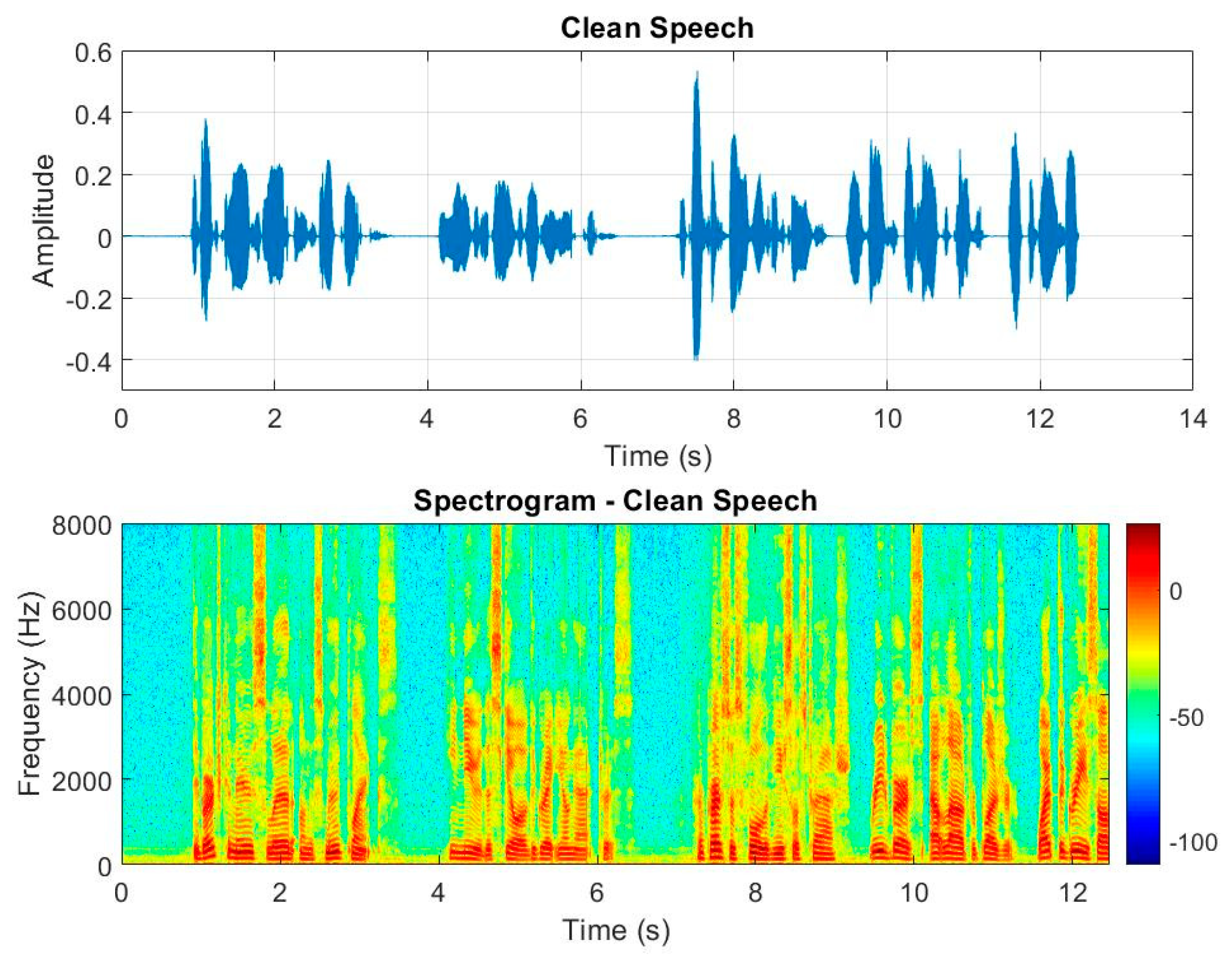 Applied Sciences | Free Full-Text | Multiresolution Speech Enhancement Based on Proposed ...