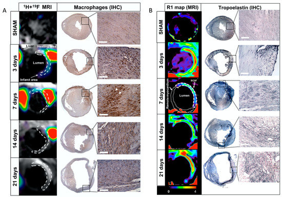 Imaging the Extracellular Matrix in Prevalent Cardiovascular Diseases