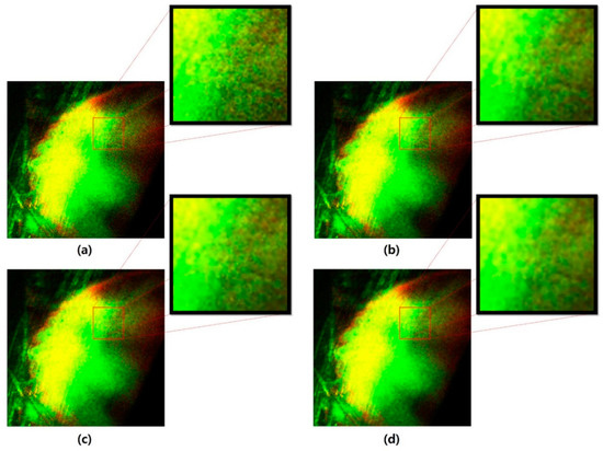 Total Variation-Based Noise Reduction Image Processing Algorithm for Confocal Laser Scanning ...