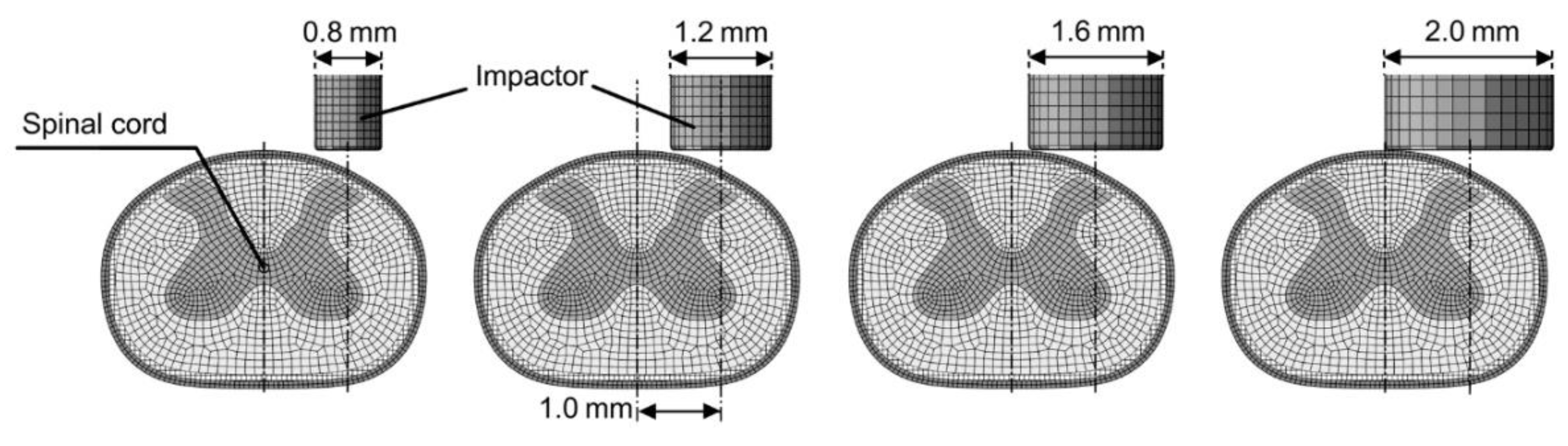 Effects of Impactor Size on Biomechanical Characteristics of Spinal ...