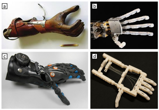 Development of a Passive Prosthetic Hand That Restores Finger Movements ...