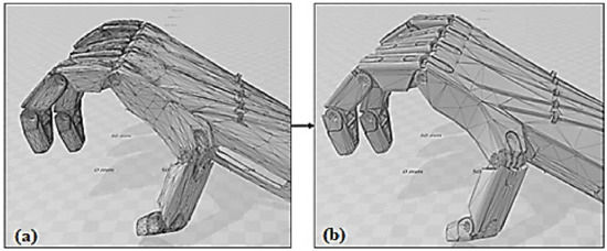 Development of a Passive Prosthetic Hand That Restores Finger Movements ...