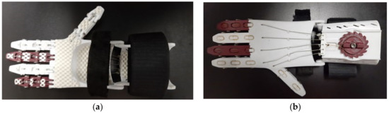 Development of a Passive Prosthetic Hand That Restores Finger Movements ...