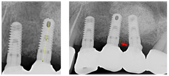 Applied Sciences | Special Issue : Bio-Inspired Biodegradable Scaffold ...
