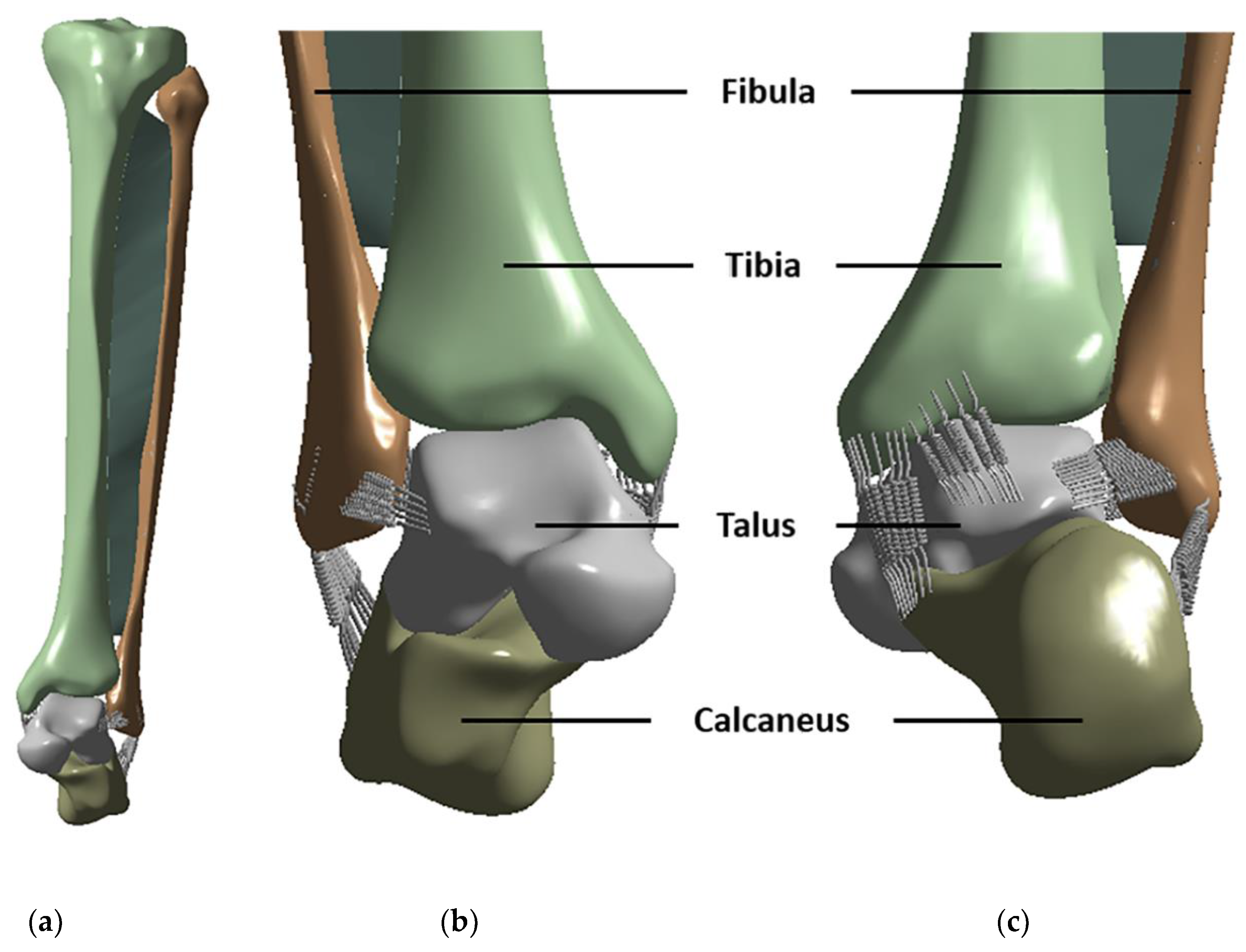 Identification of Surgical Plan for Syndesmotic Fixation Procedure ...