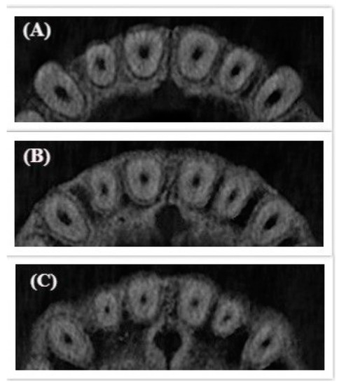 Evaluation of Cross-Sectional Root Canal Shape and Presentation of New ...