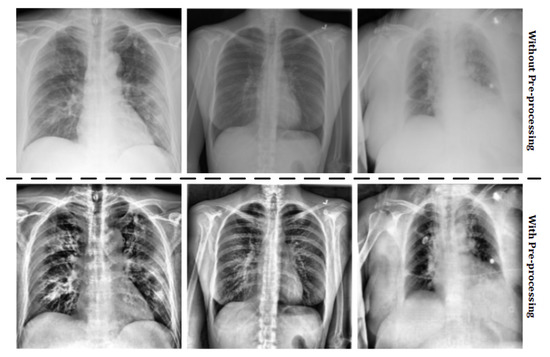 Deep Learning System for COVID-19 Diagnosis Aid Using X-ray Pulmonary ...