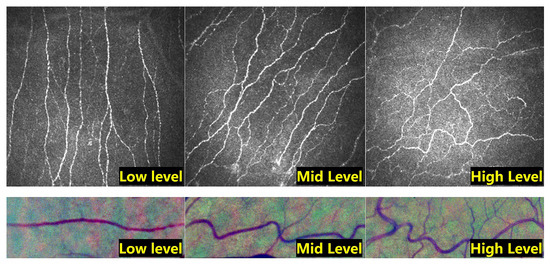 Automatic Tortuosity Estimation of Nerve Fibers and Retinal Vessels in ...