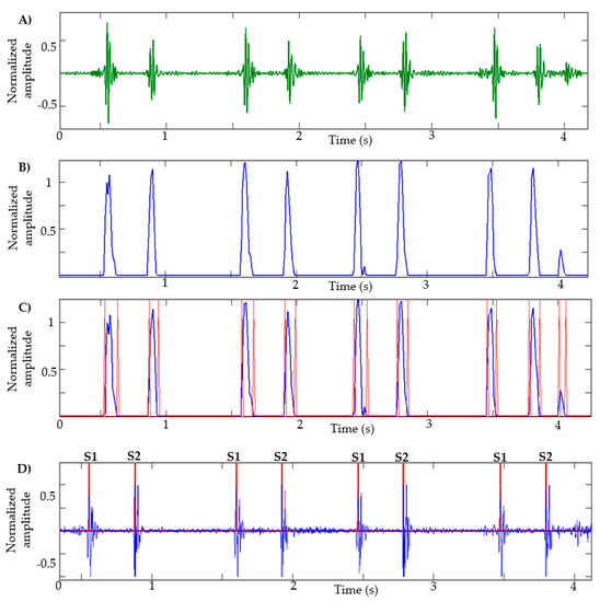 Automatic Segmentation and Classification of Heart Sounds Using ...