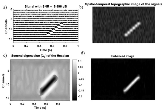 Multi-Channel Surface EMG Spatio-Temporal Image Enhancement Using Multi ...