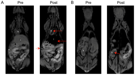 Luteinizing Hormone-Releasing Hormone (LHRH) Conjugated Magnetite ...