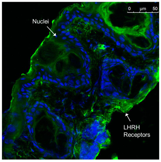 Luteinizing Hormone-Releasing Hormone (LHRH) Conjugated Magnetite ...
