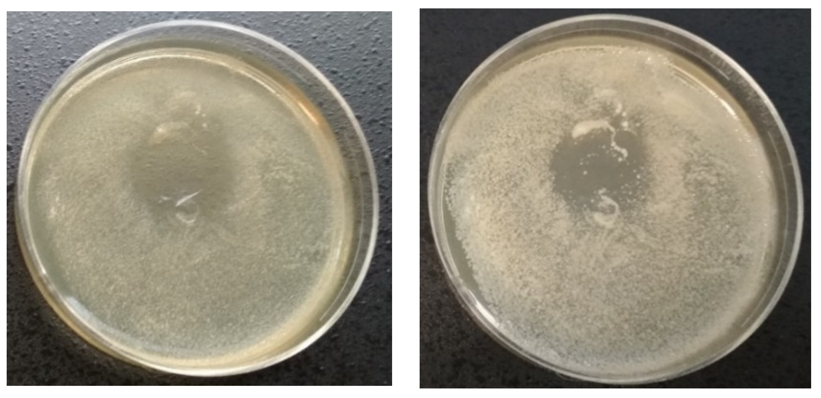 Impact of Microwave Plasma Torch on the Yeast Candida glabrata