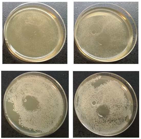 Impact of Microwave Plasma Torch on the Yeast Candida glabrata