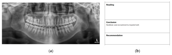 Applied Sciences | Free Full-Text | Automatic Tooth Detection and ...