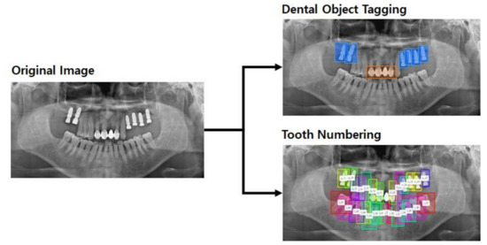 Applied Sciences | Free Full-Text | Automatic Tooth Detection and Numbering Using a Combination ...