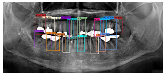 Applied Sciences | Free Full-Text | Automatic Tooth Detection and Numbering Using a Combination ...