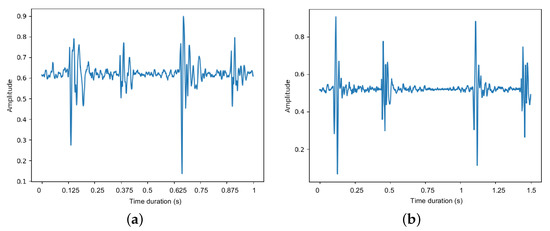 Applied Sciences | Free Full-Text | Phonocardiography Signals ...