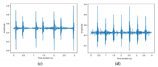 Applied Sciences | Free Full-Text | Phonocardiography Signals ...