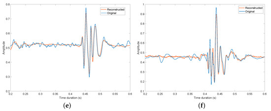 Applied Sciences | Free Full-Text | Phonocardiography Signals ...