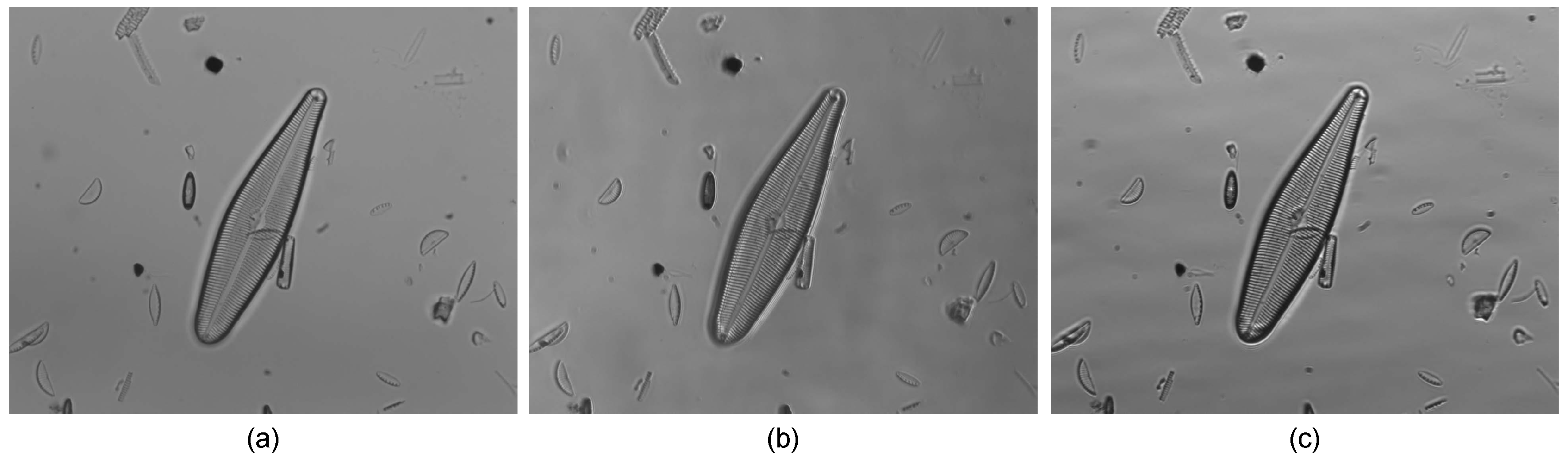 Diatoms Under Microscope Labeled