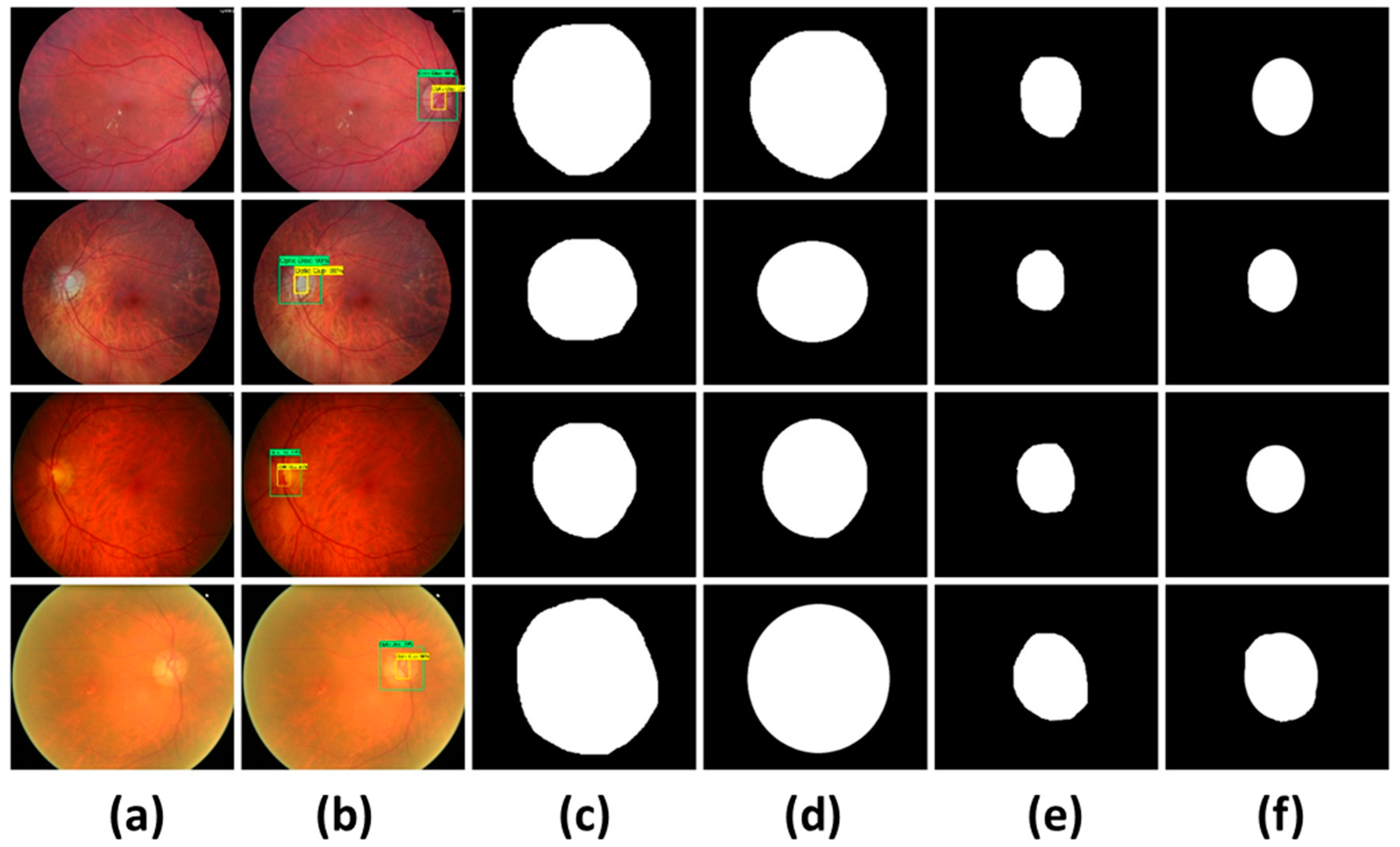 Applied Sciences | Free Full-Text | Retinal Image Analysis for Diabetes ...